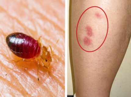 Bed Bug Shells: Size, Appearance, and Everything You Need to Know